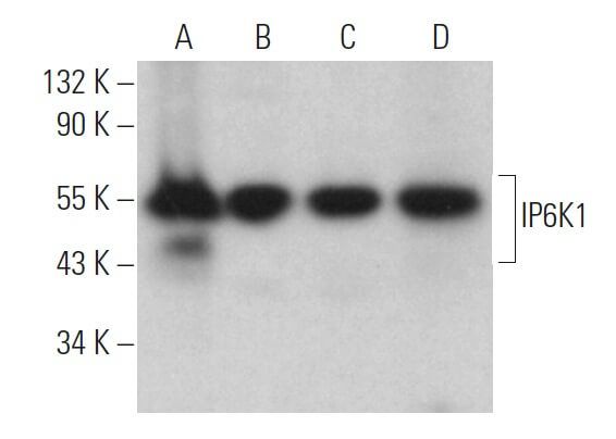 IP6K1 Antibody (E-11) | SCBT - Santa Cruz Biotechnology