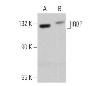 IRBP Antibody (H-6) | SCBT - Santa Cruz Biotechnology