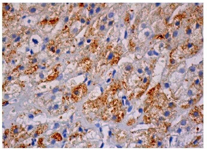 IRS-4 Antibody (C-1) | SCBT - Santa Cruz Biotechnology