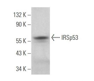 IRSp53 Antibody (46) | SCBT - Santa Cruz Biotechnology