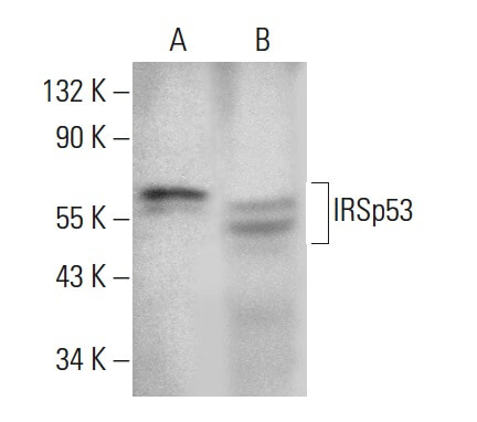 IRSp53 Antibody (46) | SCBT - Santa Cruz Biotechnology