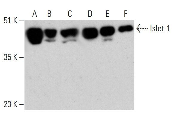 Islet-1 Antibody (B-1) | SCBT - Santa Cruz Biotechnology