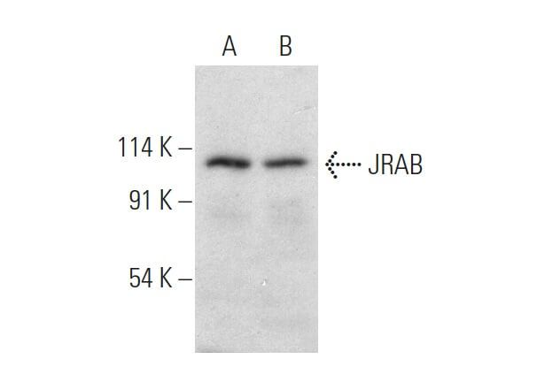JRAB Antibody (F-5) | SCBT - Santa Cruz Biotechnology