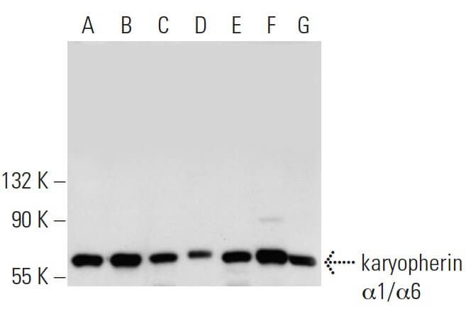 karyopherin α1/6 항체 (C-20) | SCBT - Santa Cruz Biotechnology