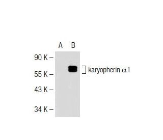 karyopherin α1 Antibody (187.1) - Western Blotting - Image 109890