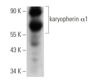 karyopherin α1 Antibody (187.1) - Western Blotting - Image 368204