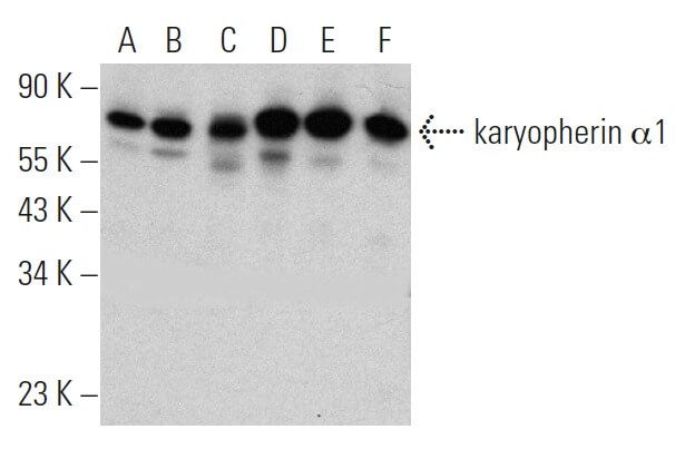 karyopherin α1抗体 (187.1) | SCBT - Santa Cruz Biotechnology