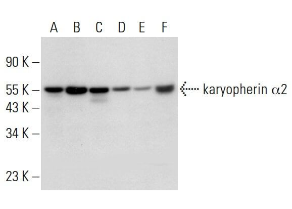 karyopherin α2 Antibody (G-7) | SCBT - Santa Cruz Biotechnology