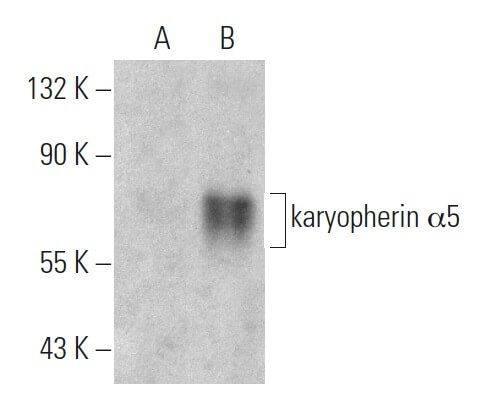 karyopherin α5 Antibody (H-4) | SCBT - Santa Cruz Biotechnology