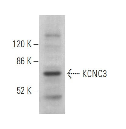 KCNC3 Antibody (D-4) | SCBT - Santa Cruz Biotechnology