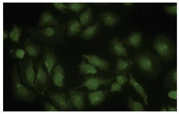 KGA Antibody (IJ-2) | SCBT - Santa Cruz Biotechnology