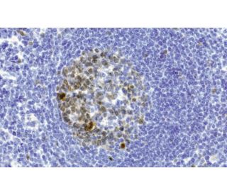 Ki67 Antibody (Ki-67) - Immunohistochemistry - Image 9250