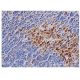Ki67 Antibody (Ki-67) | SCBT - Santa Cruz Biotechnology