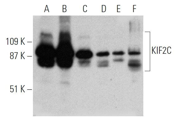 KIF2C抗体 (2488C3a) | SCBT - Santa Cruz Biotechnology