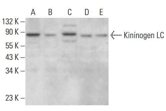 Kininogen LC Antibody (1.B.709) | SCBT - Santa Cruz Biotechnology