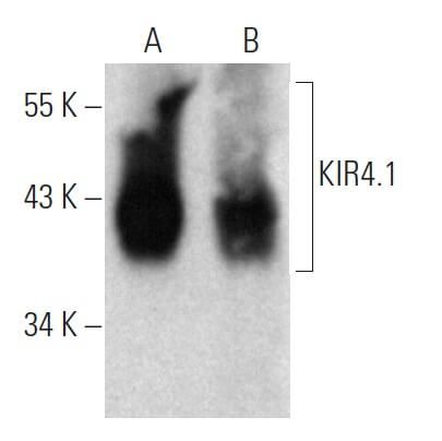 KIR4.1抗体 (1C11) | SCBT - Santa Cruz Biotechnology