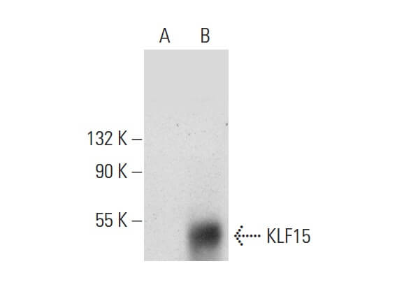 KLF15 Antibody (A-12) | SCBT - Santa Cruz Biotechnology