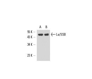 Anti-La/SSB Antibody (22A) | SCBT - Santa Cruz Biotechnology