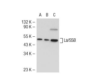 Anti-La/SSB Antibody (22A) | SCBT - Santa Cruz Biotechnology