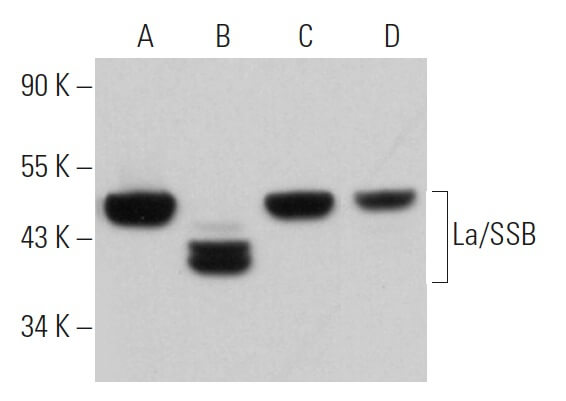 Anti-La/SSB Antibody (22A) | SCBT - Santa Cruz Biotechnology