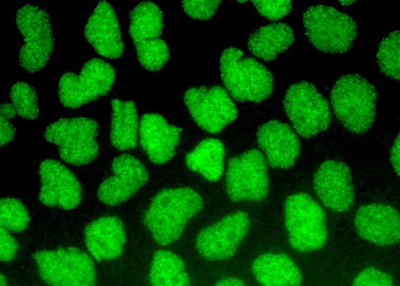 Anti-La/SSB Antibody (312B) | SCBT - Santa Cruz Biotechnology