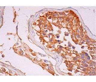 Anti-La/SSB Antibody (312B) | SCBT - Santa Cruz Biotechnology