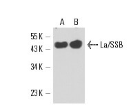 Anti-La/SSB Antibody (312B) | SCBT - Santa Cruz Biotechnology