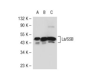 Anti-La/SSB Antibody (312B) | SCBT - Santa Cruz Biotechnology