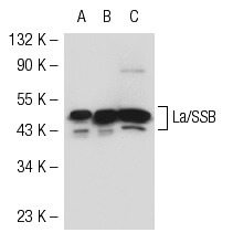 Anti-La/SSB Antibody (312B) | SCBT - Santa Cruz Biotechnology