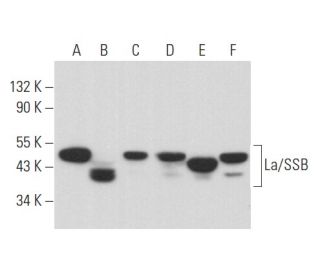 La/SSB Antibody (312B) - Western Blotting - Image 357108