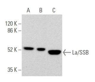 Anti-La/SSB Antibody (312B) | SCBT - Santa Cruz Biotechnology