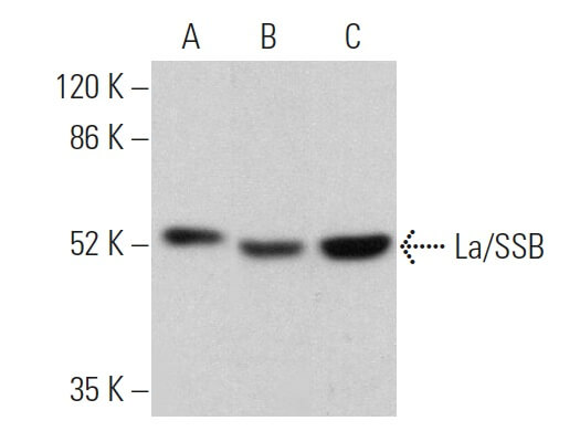 Anti-La/SSB Antibody (312B) | SCBT - Santa Cruz Biotechnology