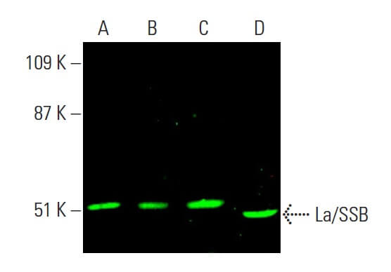 Anti-La/SSB Antibody (312B) | SCBT - Santa Cruz Biotechnology