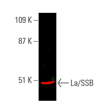 Anti-La/SSB Antibody (312B) | SCBT - Santa Cruz Biotechnology
