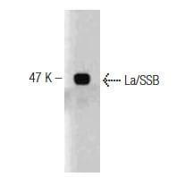 La/SSB Antibody (44) | SCBT - Santa Cruz Biotechnology
