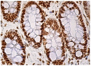 Anti-La/SSB Antibody (B-8) | SCBT - Santa Cruz Biotechnology