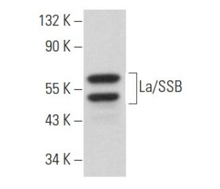 La/SSB Antibody (B-8) - Western Blotting - Image 357110
