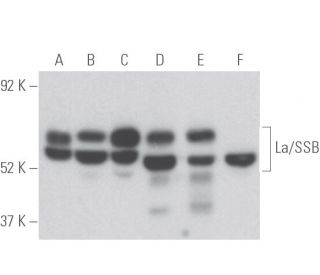 Anti-La/SSB Antibody (B-8) | SCBT - Santa Cruz Biotechnology