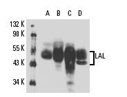 LAL Antibody (9G7F12) | SCBT - Santa Cruz Biotechnology