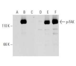 Western blot analysis of FAK phosphorylation in non-transfected: sc-117752 (A,D),...