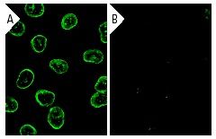 Lamin A/C siRNA (h), shRNA and Lentiviral Particle Gene Silencers ...