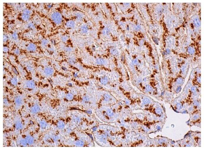 Anti-LAMP-1 Antibody (1D4B) | SCBT - Santa Cruz Biotechnology