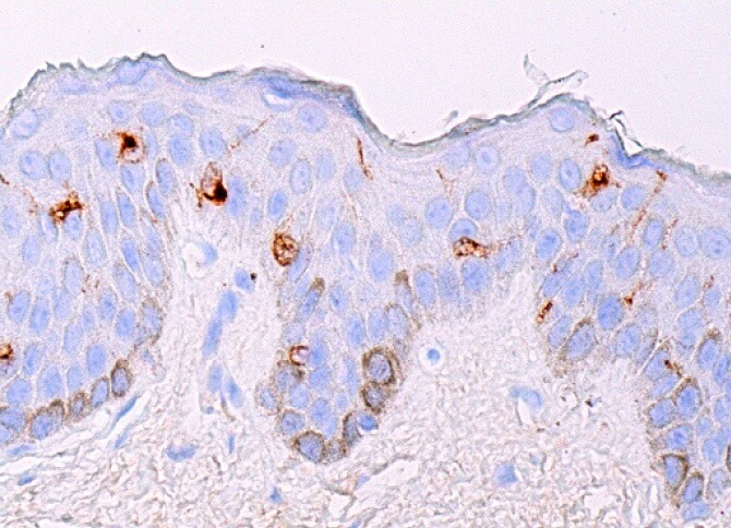Langerin Antibody (H-4) | SCBT - Santa Cruz Biotechnology