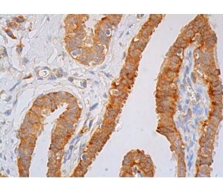 LARP1 Antibody (A-8) - Immunohistochemistry - Image 386807