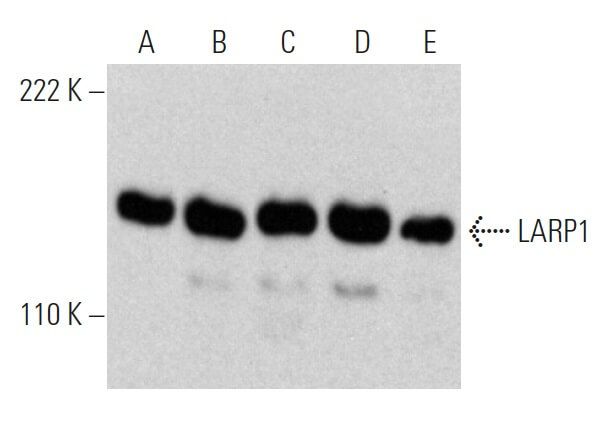 LARP1抗体 (A-8) | SCBT - Santa Cruz Biotechnology