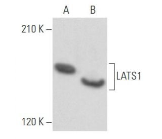 LATS1 Antibody (G-12) - Western Blotting - Image 354968