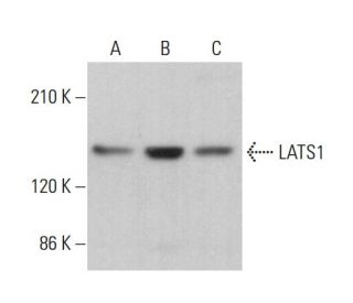 LATS1 Antibody (G-12) - Western Blotting - Image 381423