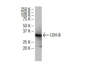 Anti-LDH-B Antibody (431.1) | SCBT - Santa Cruz Biotechnology