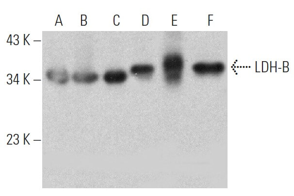 Anti-LDH-B Antibody (431.1) | SCBT - Santa Cruz Biotechnology