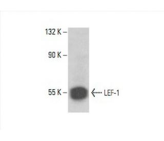 Anti-LEF-1 Antibody (B-10) | SCBT - Santa Cruz Biotechnology